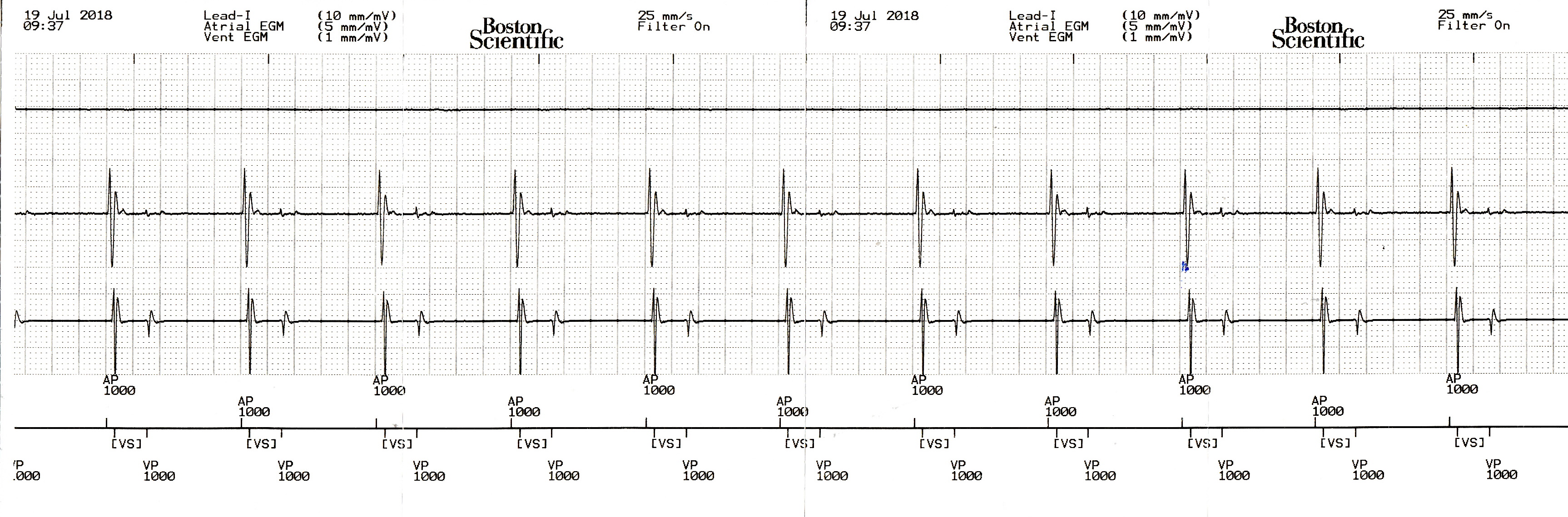 Cardiac Rhythm Device Troubleshooting