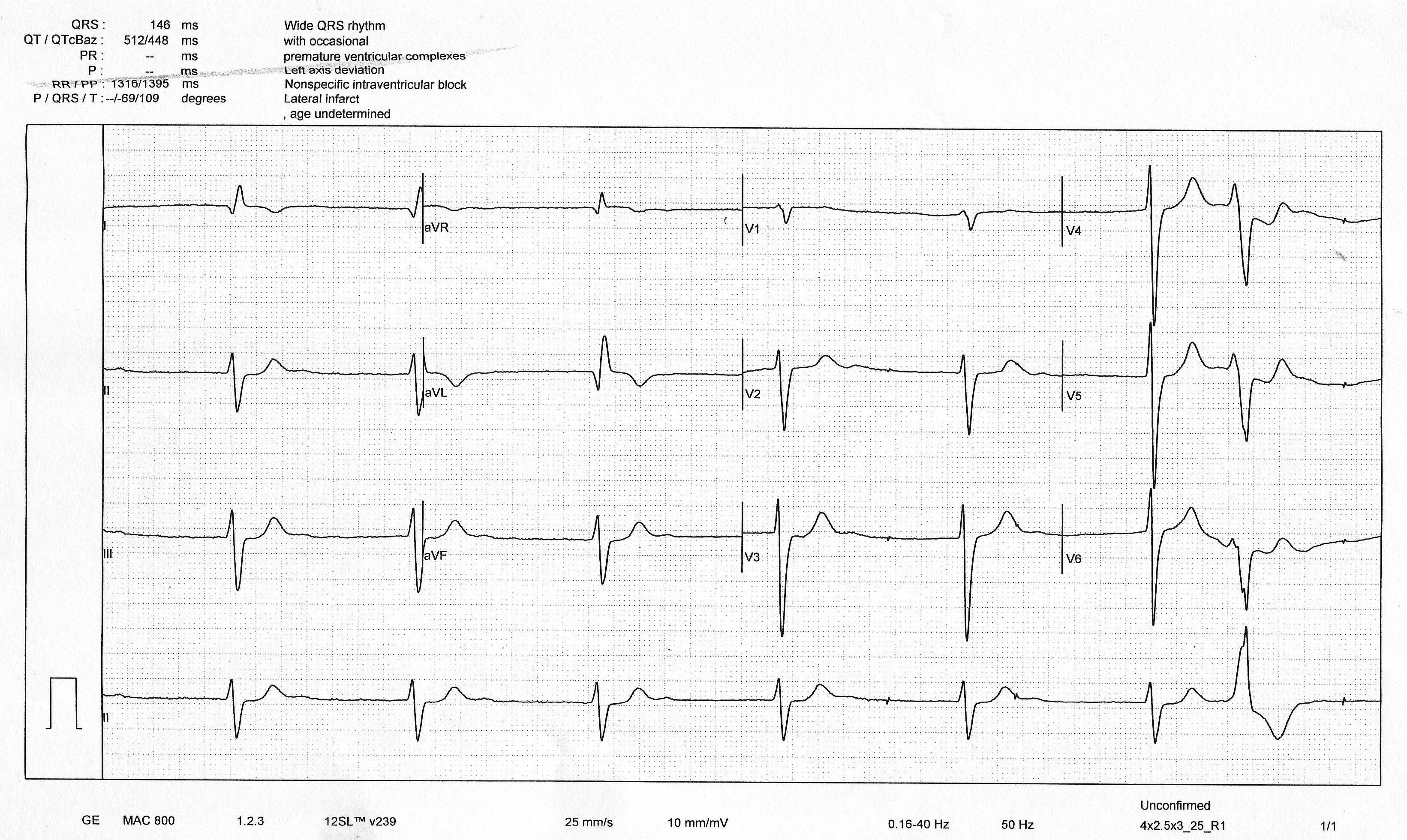 Cardiac Rhythm Device Troubleshooting