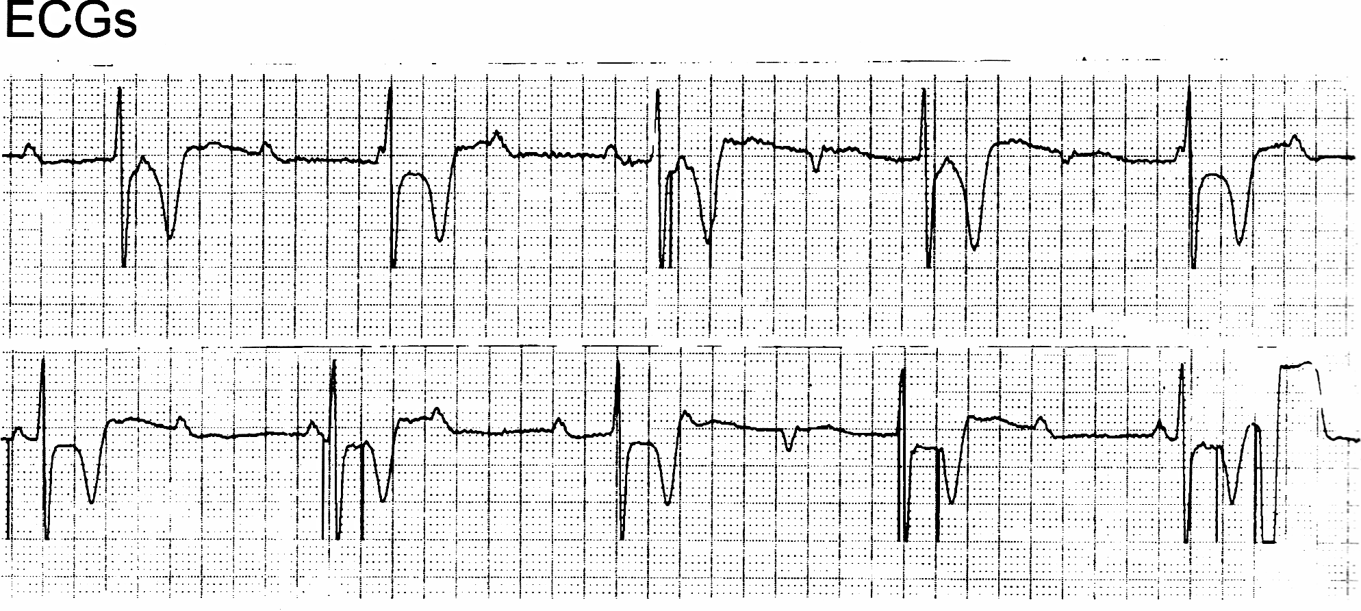 Cardiac Rhythm Device Troubleshooting