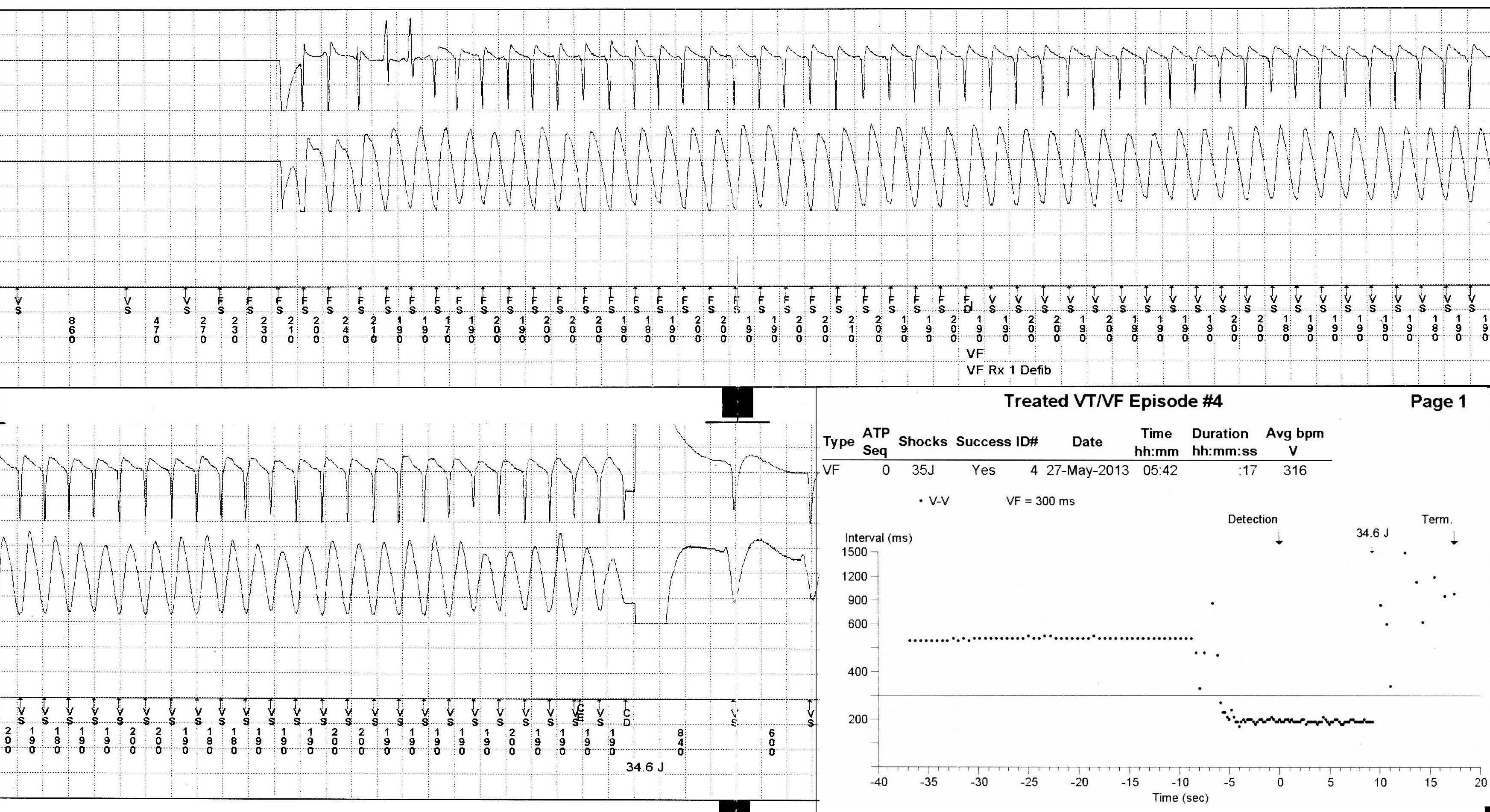 SCA Myths vs Facts #4